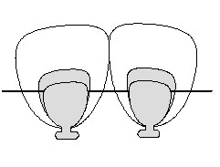 低料金を目指し矯正歯科へようこそ！